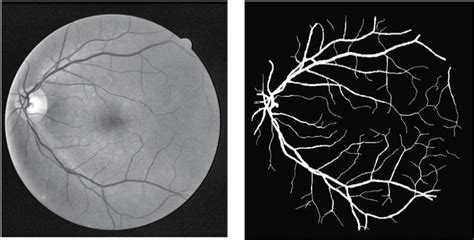 Patch Extraction Showing A Pre Processed Image Top And Patches Download Scientific Diagram