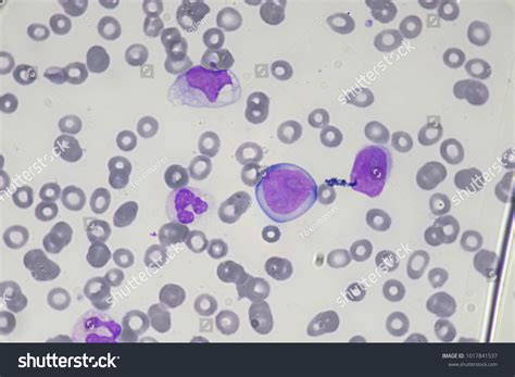 Myeloblast