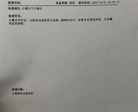 有没有腓骨远端骨折的兄弟 NGA玩家社区