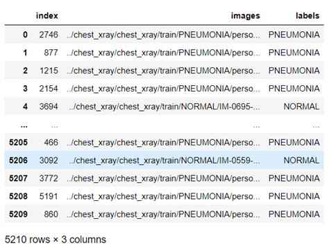 Github Abhijitgokhalepneumonia Detection Chest Xray Images Using Cnn