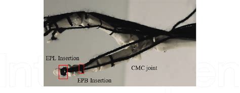 The Artificial Epl And Epb Insertions Of The Thumb Download Scientific Diagram