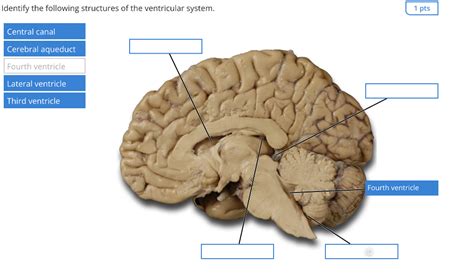 Solved Identify The Following Structures Of The Ventric