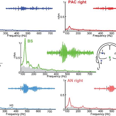 Source Level Ffr Waveforms And Spectra Along The Ascending Auditory 416