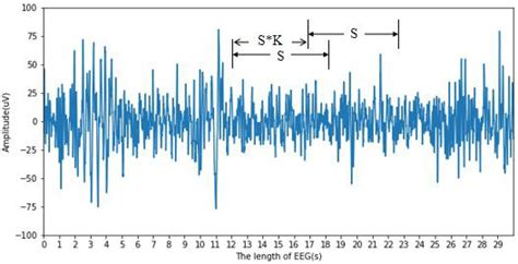 EEG Signal Segmentation Process Download Scientific Diagram