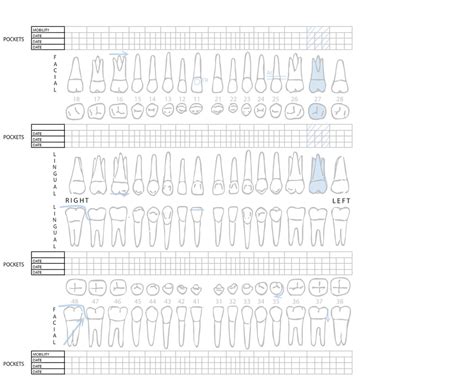 Dental Charting Diagram