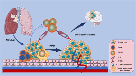 Frontiers Hyperprogressive Disease In Non Small Cell Lung Cancer