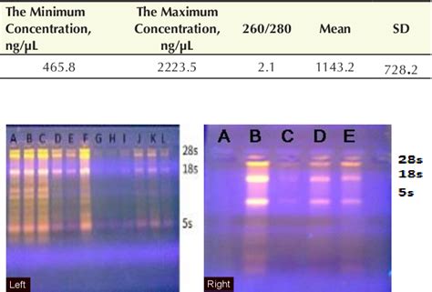 Table From Comparison Of Methods Of RNA Extraction From Breast And Gastric Cancer Tissues