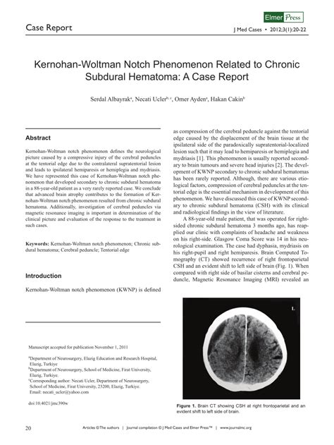 Pdf Kernohan Woltman Notch Phenomenon Related To Chronic Subdural