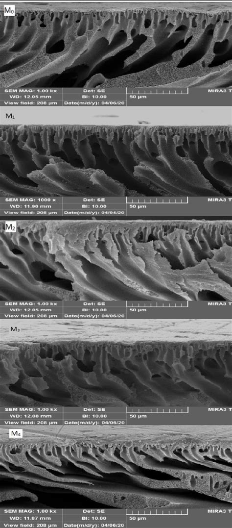 Surface Electron Micrographs Of The Membranes Cross Sectional Areas