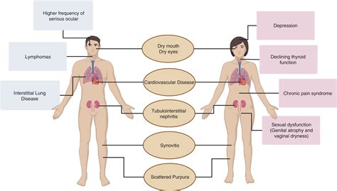 Impact Of Sex Differences On The Clinical Presentation Pathogenesis