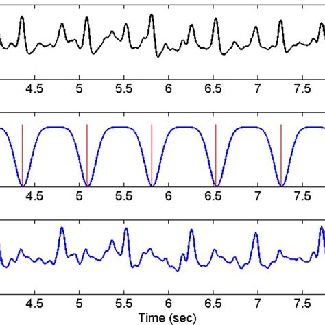 Pcg Spectrogram And Ose Waveforms A 3 Seconds Of Raw Pcg Record Download Scientific Diagram