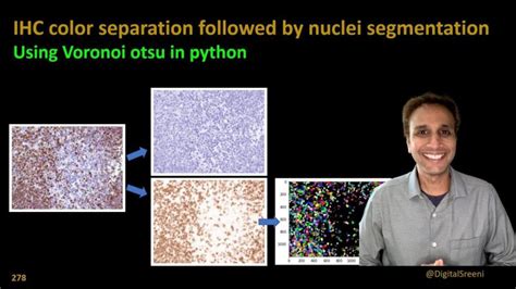 Python Deeplearning Microscopy Bioimageanalysis Sreenivas B