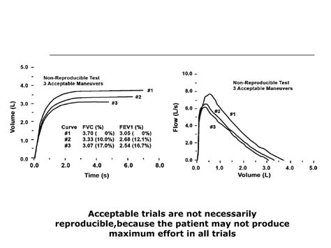 Spirometry Interpretation PPT