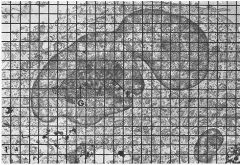 Figure 1 From Ultrastructure Of The Nucleolus During The Chinese Hamster Cell Cycle Semantic