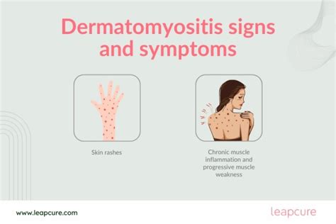 Dermatomyositis Causes Symptoms And Treatment Options