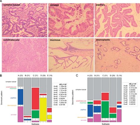 morphological crc patterns a morphological crc patterns scored in