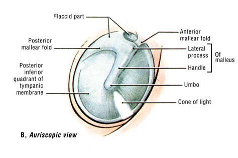 Temporal Bone Tympanic Membrane Ranzcrpart1 Wiki Fandom Powered By Wikia