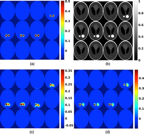 Anatomical Image Guided Fluorescence Molecular Tomography Reconstruction Using Kernel Method