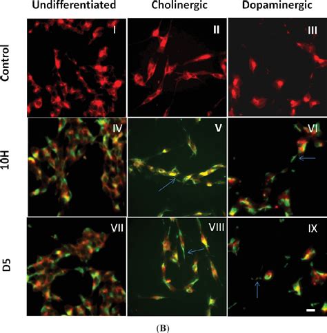 Figure 3 From Toxic Oligomeric Alpha Synuclein Variants Present In