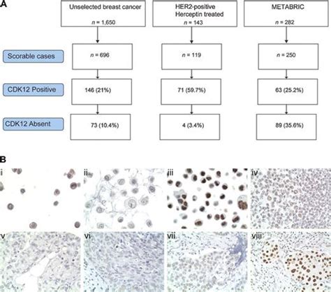 Evaluation Of Cdk12 Protein Expression As A Potential Novel Biomarker