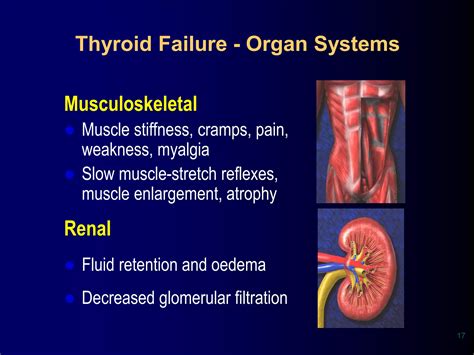 Thyroid Disorders Hyperthyroidism And Hypothyroidism Pdf
