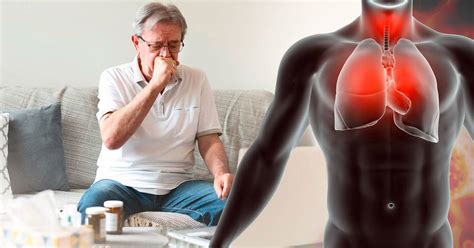 Pulmonary Embolism Its Severity And Timeframe To Fatality