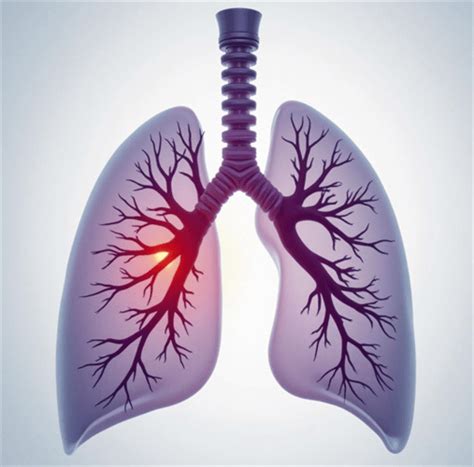 肺癌化疗期间，如何科学饮食？成都普济肿瘤专家的建议患者食物康复