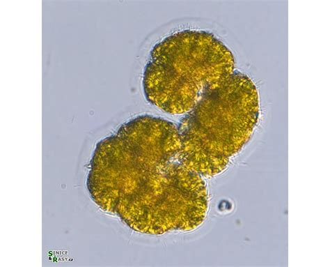 Botryococcus Braunii Galerie