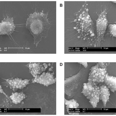 Scanning electron microscope images scale bar 10 μm after the Download Scientific Diagram