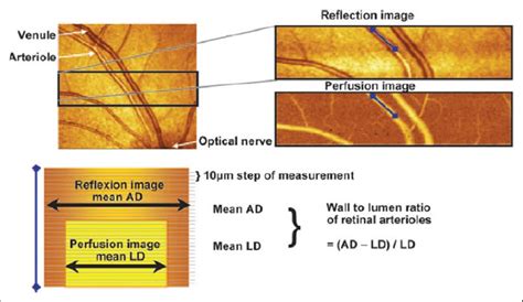 Example Of Images Obtained With Scanning Laser Doppler Flowmetry Download Scientific Diagram