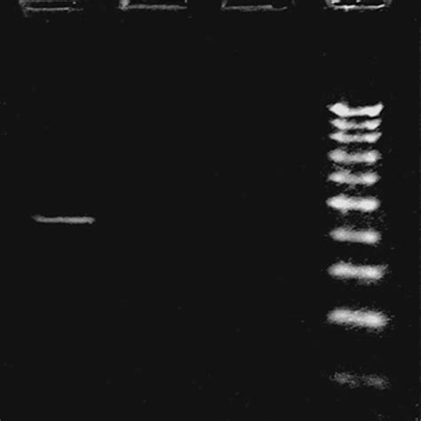 Assessment Of Genomic Dna Contamination In Mtdna Isolated By The
