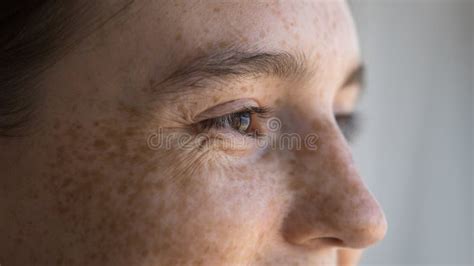 Cheerful Freckled Young Woman Looking Away Smiling Laughing Stock
