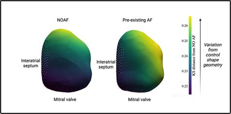 Automated Left Atrial Segmentation And Statistical Shape Analysis To