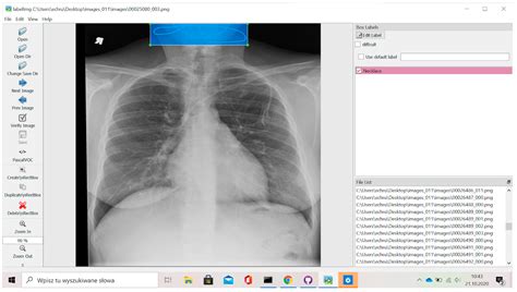 Artificial Intelligence Shortens Reading Times Of Radiologists For Chest X Rays Radiography