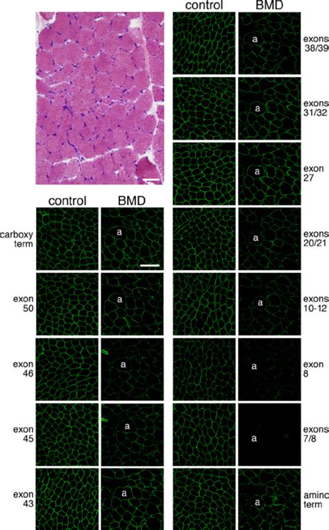 Schematic Representation Of Dystrophin A Localization Of The