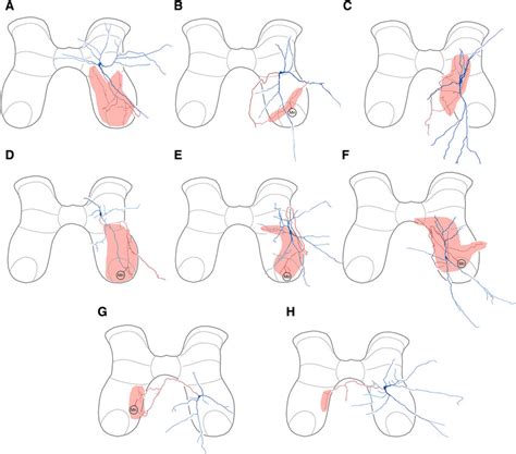 Reconstructions Of Inhibitory Multifunctional Interneurons A F