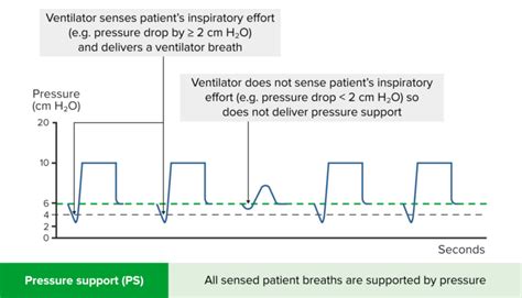 Modes Of Ventilation Peep Cpap A C And More Medical Library