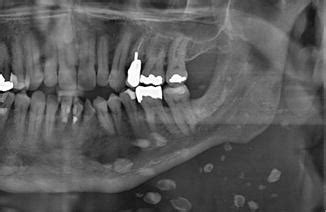 Diseases Of The Oral Mucosa And Soft Tissues General Aspects Pocket Dentistry