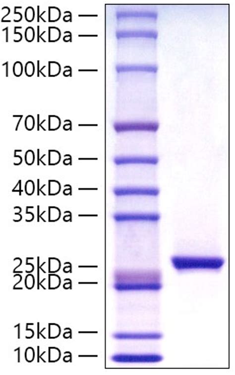 Recombinant Human C Reactive Protein Crp Protein Rpcb0817 Assay Genie Japan