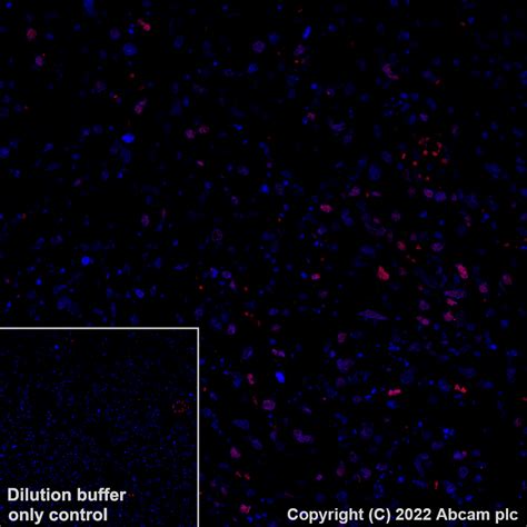 Alexa Fluor® 647 Alexa Fluor® 647 Anti Batf3 Antibody Epr26558 38