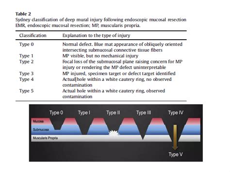Emr Endoscopic Mucosal Resection Pptx