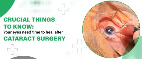 Why Do My Eyes Itch So Much After Cataract Surgery