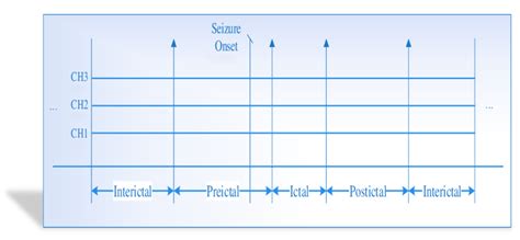 Epilepsy Stages Diagram Download Scientific Diagram