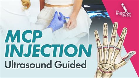Ultrasound Guided Mcp Joint Injection Step By Step Technique Youtube
