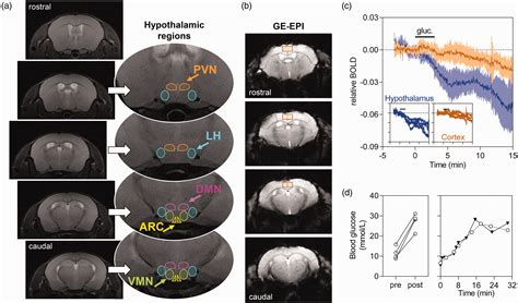 Hypothalamic Nuclei Table