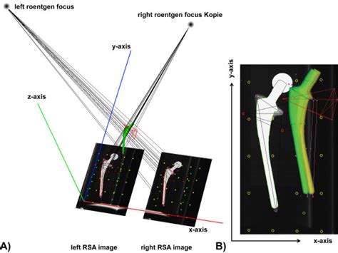 Reference Rsa Radiograph A Migration Is Represented With Respect To A