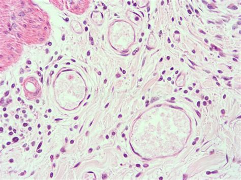 Histology Of Human Gallbladder Tissue Stock Image Image Of Columnar Show 153109211