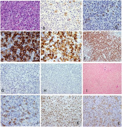Lymph Nodes Histological And Immunohistologic Features A The Lymph Download Scientific