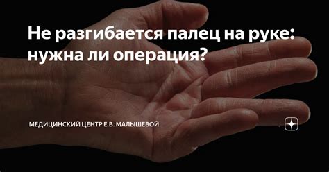 Не разгибается палец на руке: нужна ли операция? | Медицинский центр Е ...