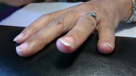 Are These Eggshell Nails Salon Geek Salon Professionals Forum